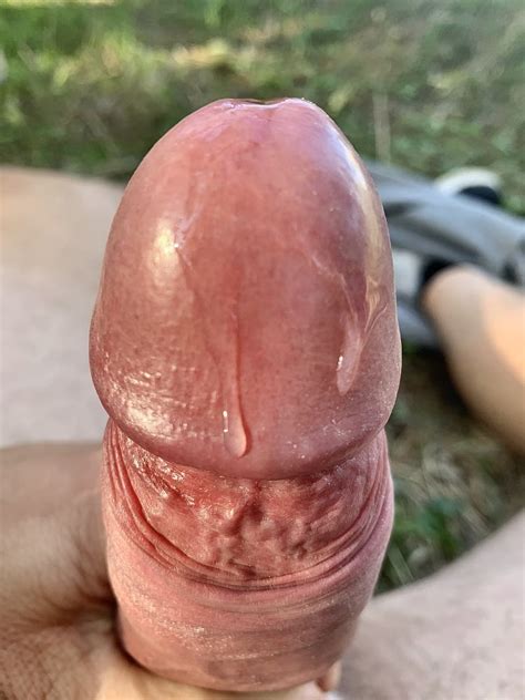 Big Glans Pics Xhamster