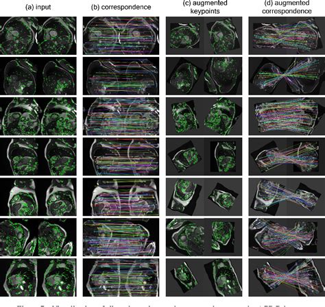 figure 7 from keypoint augmented self supervised learning for medical image segmentation with