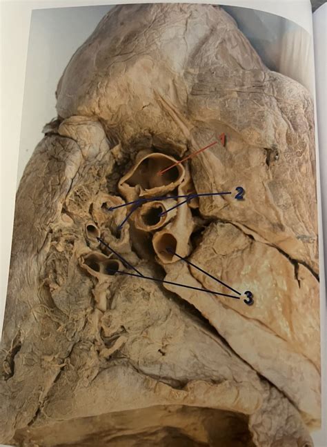 Lung Diagram Quizlet
