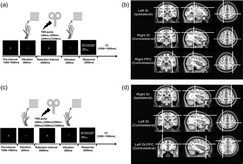[pdf] the causal role of the prefrontal cortex and somatosensory cortex in tactile working