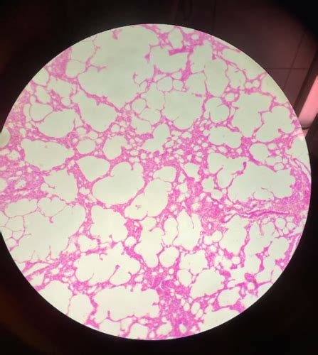 Epithelial And Connective Tissue Flashcards Quizlet