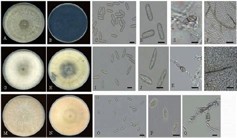 Morphological Characteristics Of Colletotrichum Gloesporioides And C