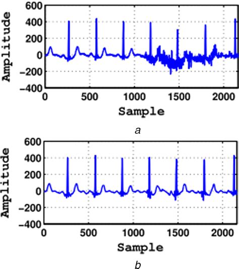ecg denoising using dwt sym5 a original ecg signal download scientific diagram