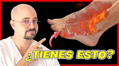 PELIGRO ARDOR En Los PIES Esto SIGNIFICA El ENTUMECIMIENTO Y