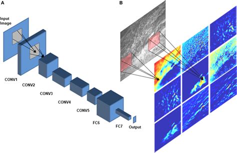 Frontiers Prospects For Theranostics In Neurosurgical Imaging