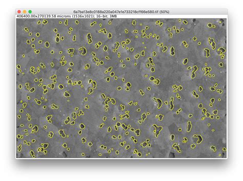 preprocessing to improve segmentation image analysis image sc forum