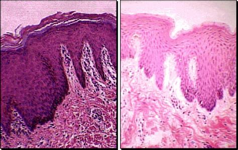 Epithelium Histology Stratified Squamous Epithelium Histology Slide