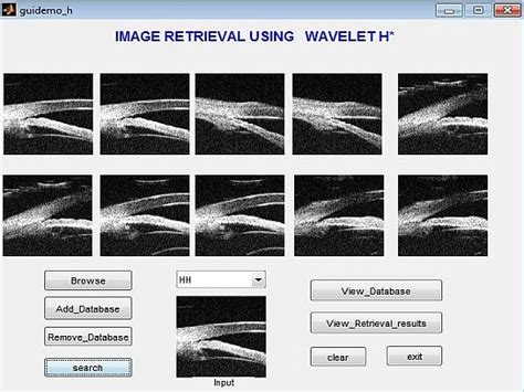 medical image retrieval using energy efficient wavelet