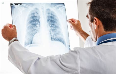 Fibrosis Pulmonar qué es síntomas y tratamiento Top Doctors