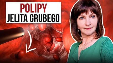 POLIPY jelita grubego Jak uniknąć powstawania i nawrotów Przyczyny