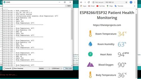 IoT Based Patient Health Monitoring System Using ESP8266 ESP32
