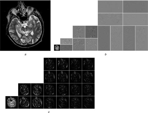 figure 1 from ct and mr image information fusion scheme using a cascaded framework in ripplet