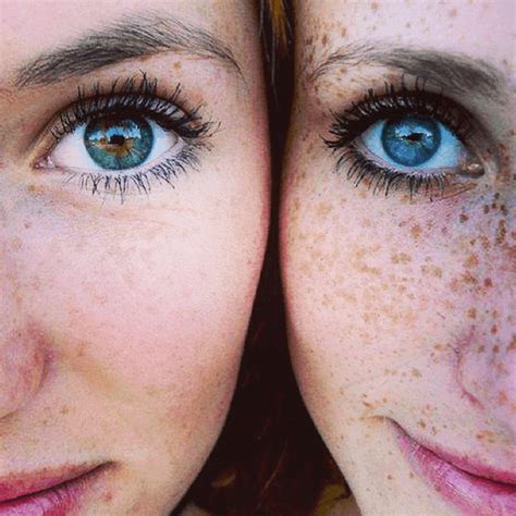 Red Hair Pale Skin Freckles Telegraph