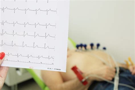 badanie ekg serca medica centrum chodzież Medica Centrum Prywatne