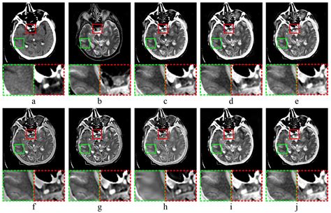 sensors free full text multi modality medical image fusion using convolutional neural
