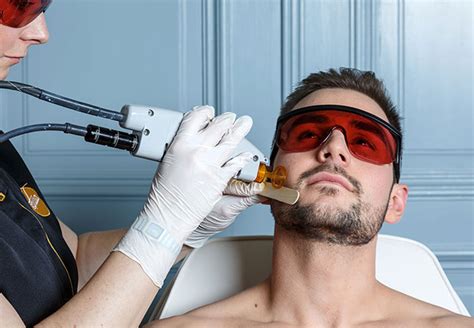 Le n1 de l épilation laser pour homme Envie de résultats