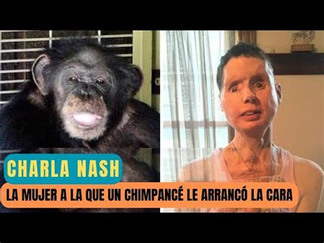 La mujer a la que un chimpancé le arrancó la cara y manos charlanash