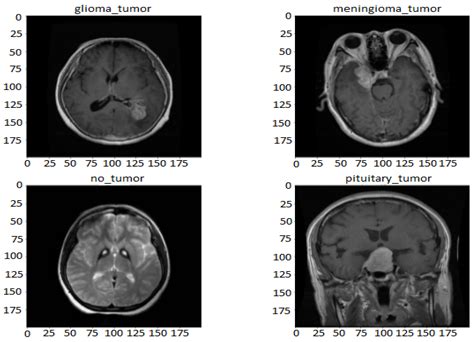 applied sciences free full text a cnn based strategy to classify mri based brain tumors