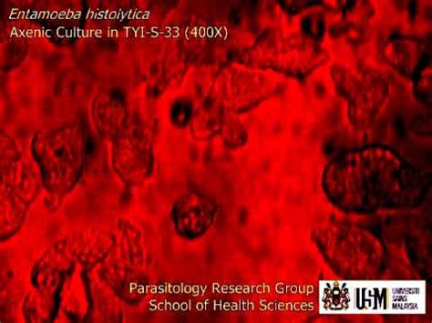 Parasitology Video Entamoeba Histolytica Trophozoites 100X YouTube