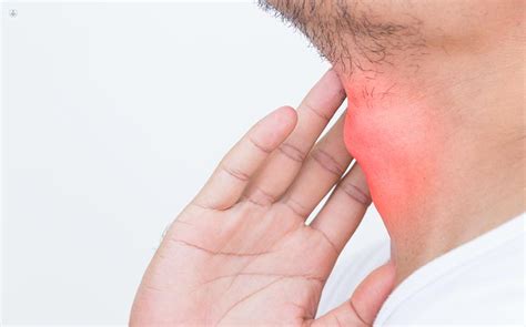 Bocio Cuáles son sus síntomas causas y tratamientos Top Doctors