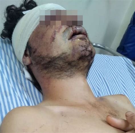Polícia encontra celular do estudante de letras brutalmente agredido