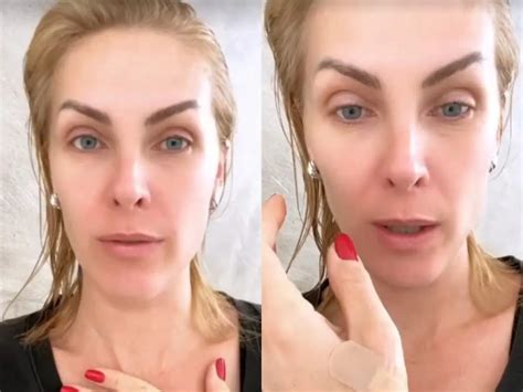 Ana Hickmann Agradece Mensagens De Apoio Ap S Viol Ncia Dom Stica