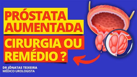 PRÓSTATA AUMENTADA REMÉDIO OU CIRURGIA YouTube
