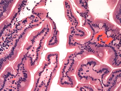 Histology Small Intestine Tissue Biology Cell Biology Science The