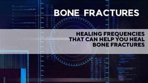 Bone Fractures Healing Frequencies That Can Help You Heal Bone