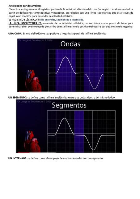 Electrocardiograma Evleyn Rosmery Orrala Tarco UDocz