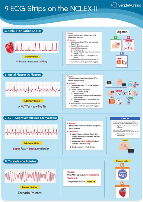 9 ECG Strips On The NCLEX Simple Nursing 9 ECG Strips On The NCLEX
