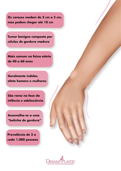 Lipoma O que é fotos e como tratar esses nódulos de gordura