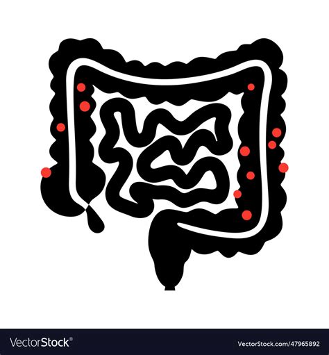 Diverticulitis And Diverticulosis Royalty Free Vector Image