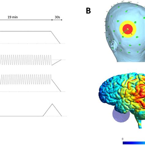 The Transcranial Electric Stimulation A Anodal Tdcs Tacs Otdcs