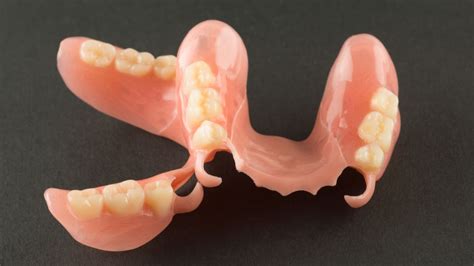 Prótese dentária flexível saiba tudo sobre e preço