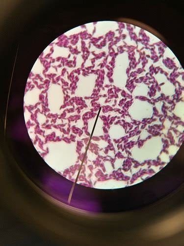 Yeast Molds Part 1 IMAGES Flashcards Quizlet