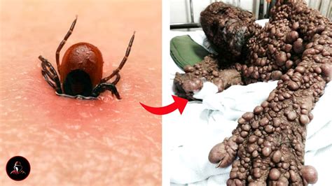 Los 10 Insectos Mas Peligrosos Del Mundo YouTube