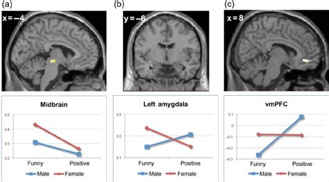 brain activation maps depicting sex differences top statistical download scientific diagram