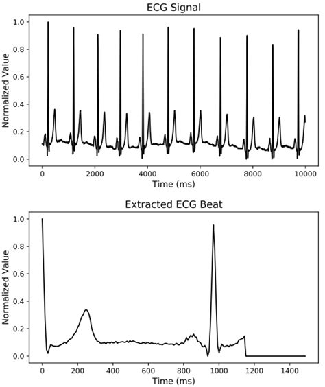 learn how to classify ecg signals with dl in knime knime