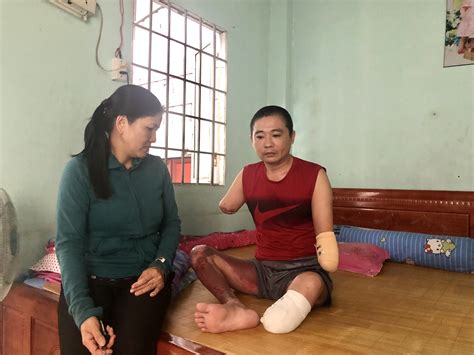 Chồng bị điện giật cụt tay chân gánh nặng đổ lên vai vợ trẻ Báo Bà