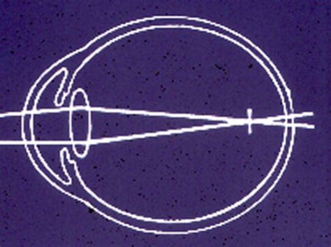 Biomed Eye Exam Flashcards Quizlet
