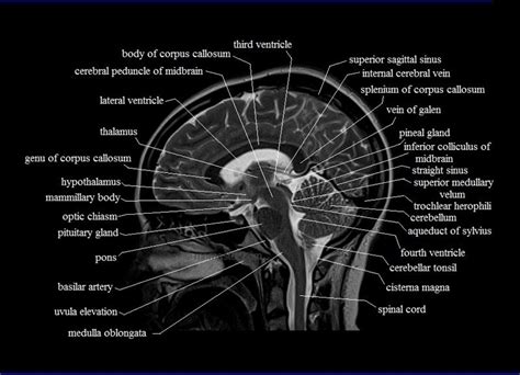 Mri Anatomy Of Brain Anatomy