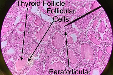 Thyroid Gland Histology Labeled Diagram
