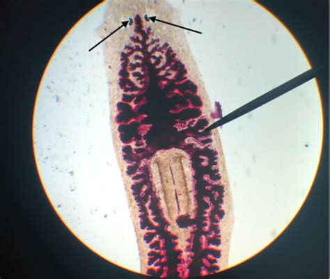 Phylum Platyhelminthes LAB Flashcards Quizlet