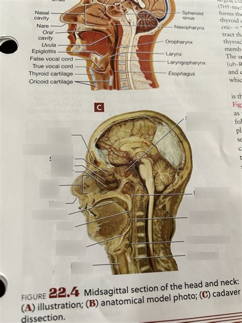 Midsagittal Section Of The Head And Neck Cadaver Dissection Diagram