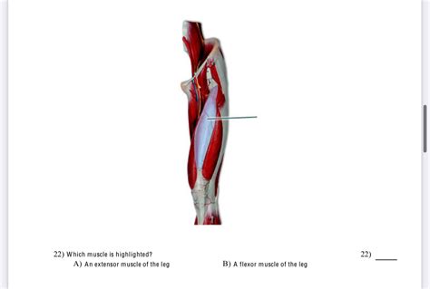 Solved Which Muscle Is Highlighted A An Extensor Muscle Of Chegg