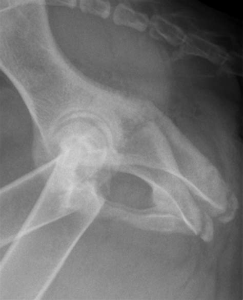 Tips Techniques For Pelvic Radiography Clinician S Brief