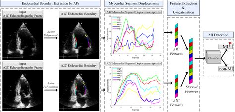 early myocardial infarction detection over multi view echocardiography papers with code