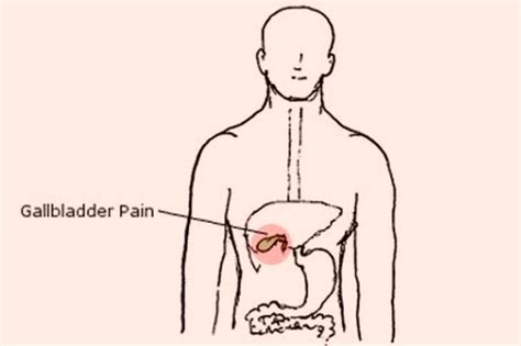 Gallbladder Pain Location Symptoms Relief And Treatment HubPages