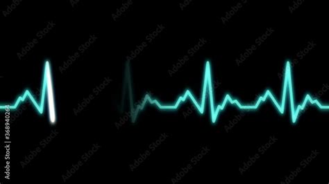 Heartbeat Monitor Ekg Line Monitor Shows Heartthrob Seamlessly Loop